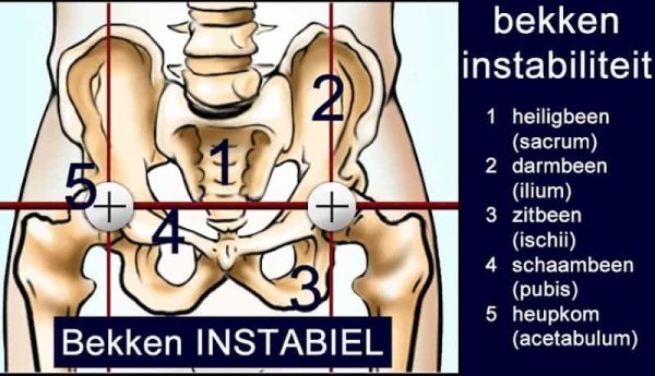 Bekkeninstabiliteit – Rugpijnweg.nl