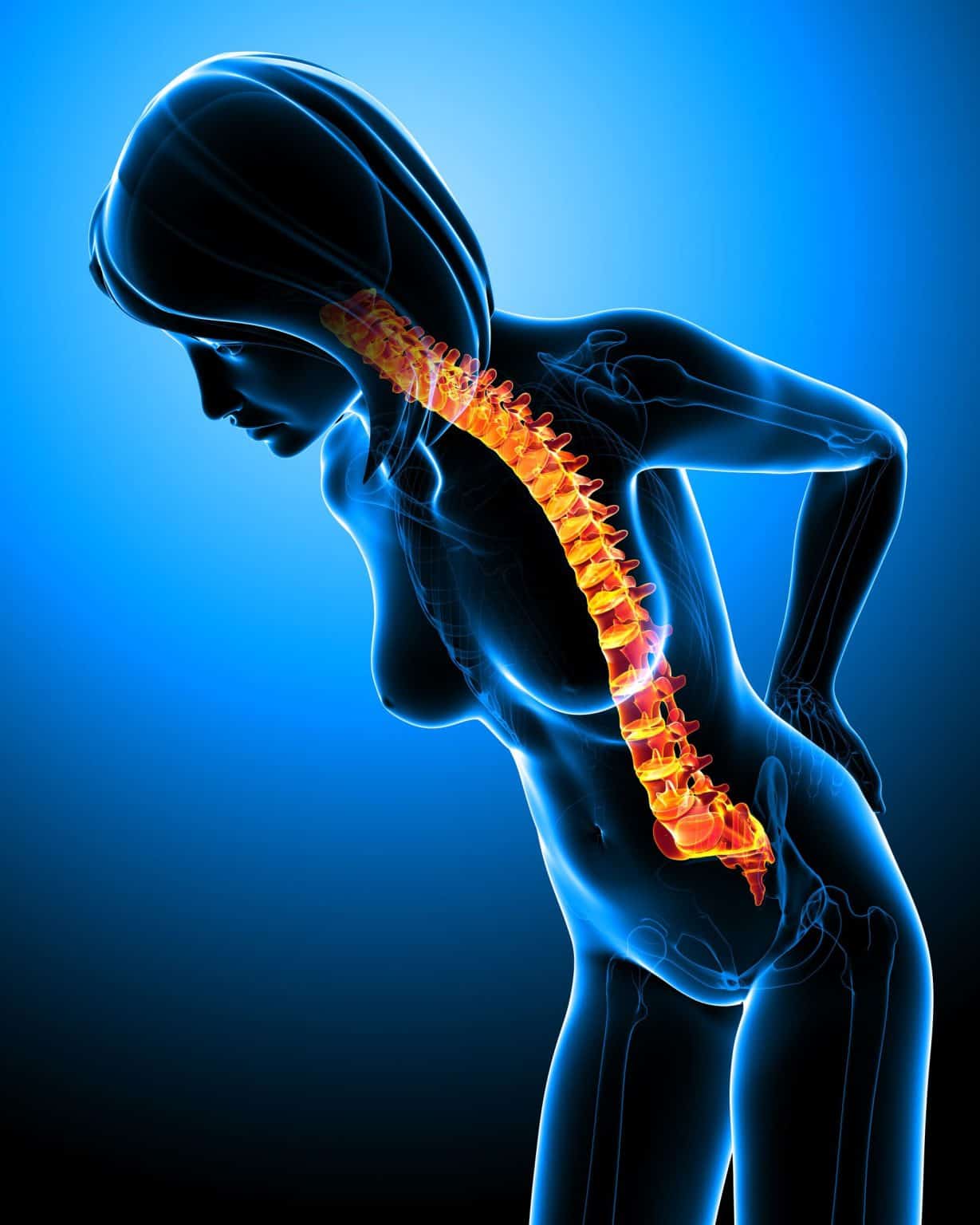 Mythe Versleten Tussenwervelschijf – Rugpijnweg.nl