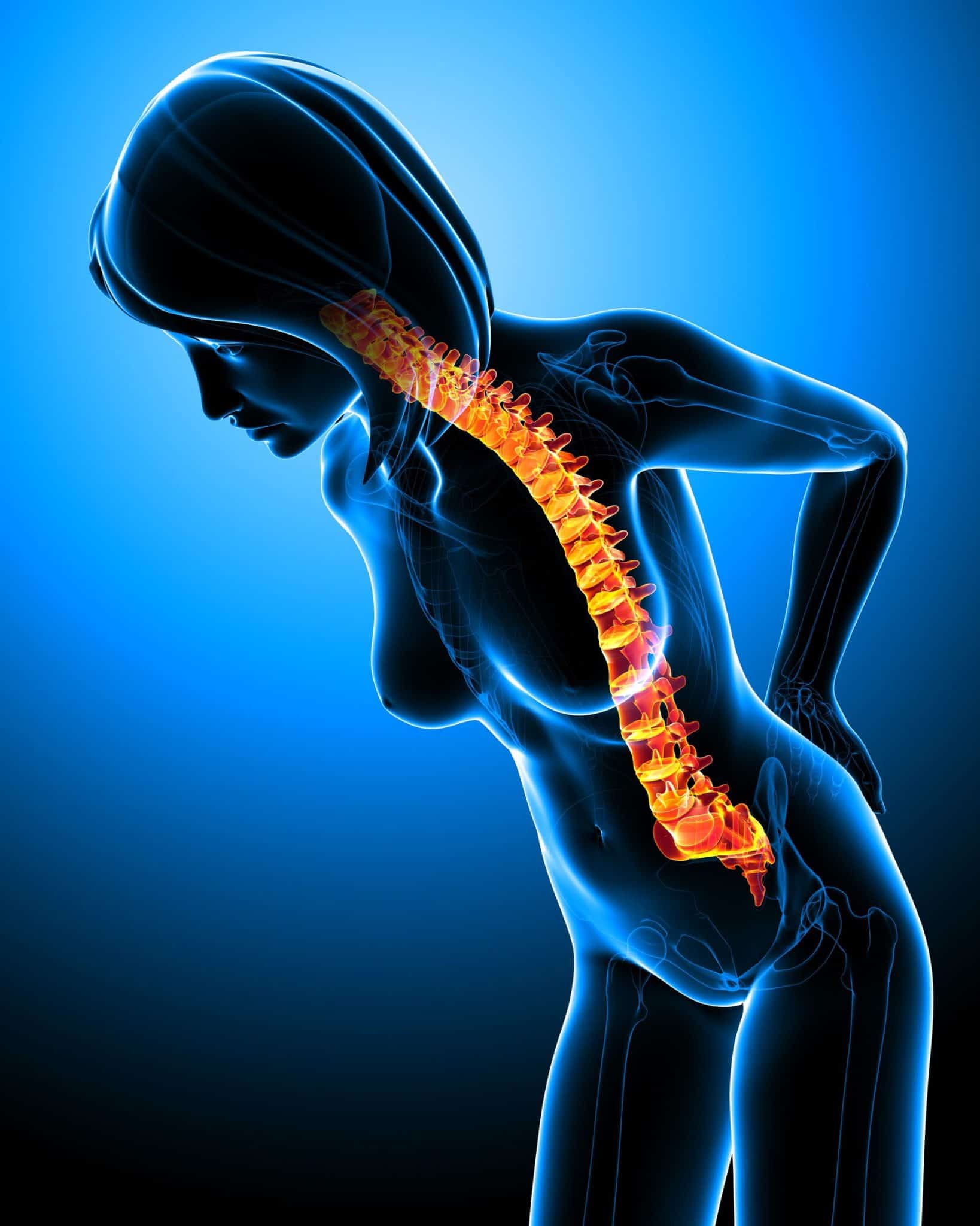 Wat U Moet Weten Over Lage Rugpijn – Rugpijnweg.nl