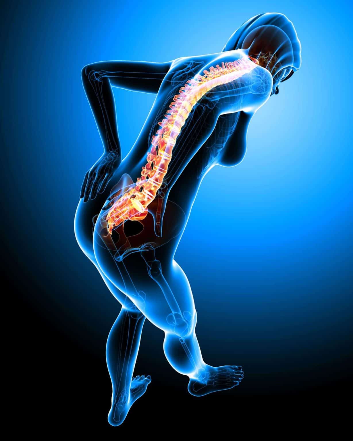 Wat U Moet Weten Over Lage Rugpijn – Rugpijnweg.nl